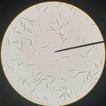 Training a Deep Learning Model for Cell Counting in 17 Lines of Code ...