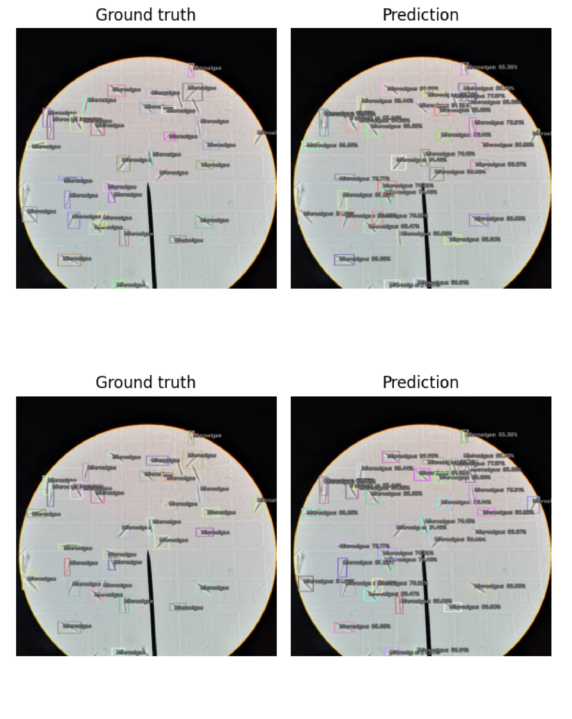 Training a Deep Learning Model for Cell Counting in 17 Lines of Code ...